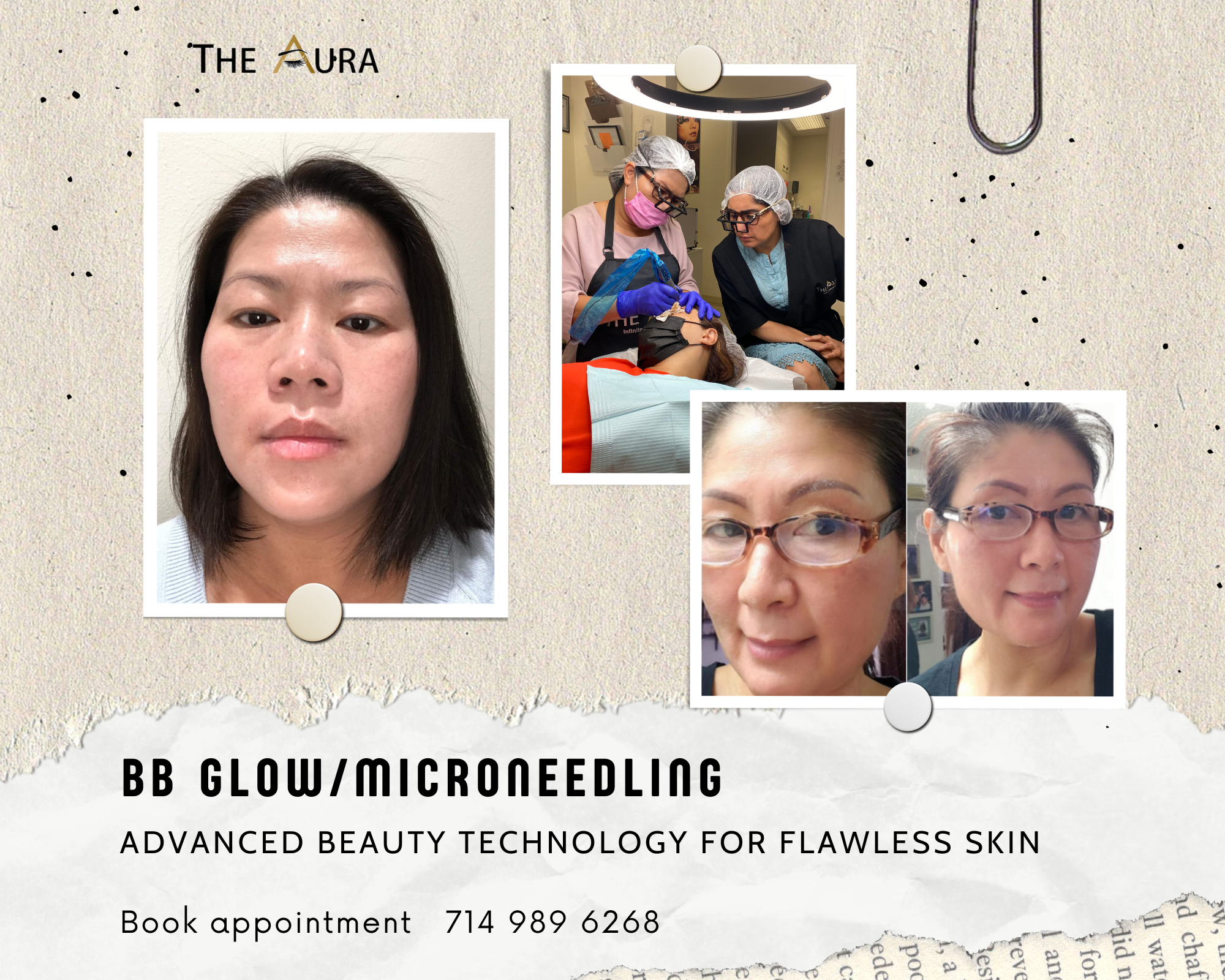 BB Glow/Microneedling: Advanced beauty technology for skin