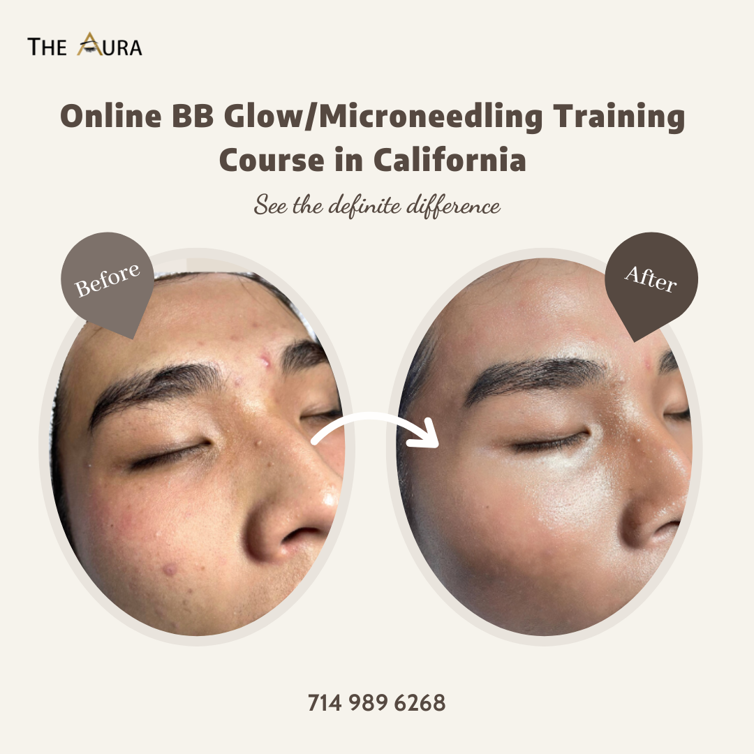 online BB Glow/Microneedling training program in California